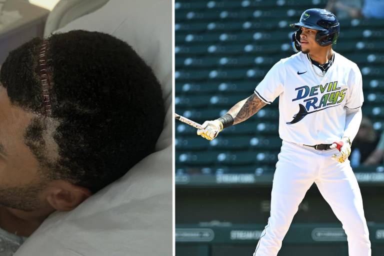 Prospecto de los Rays, Xavier Isaac, revela cirugía cerebral que le ...
